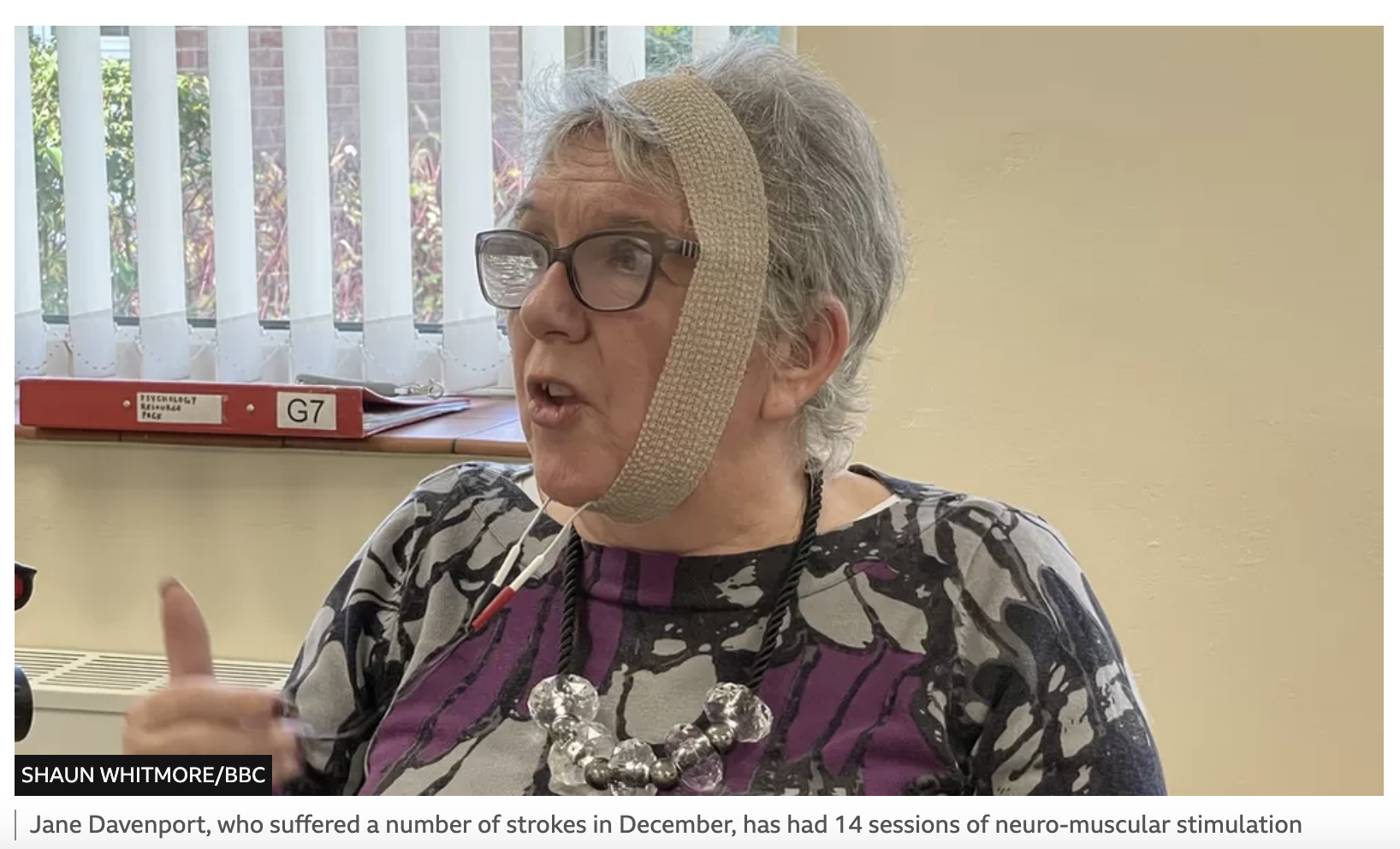 Norwich speech therapist hails new technique for stroke patients ...